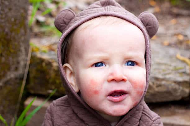 How to Stop Baby Scratching Face at Night: Tips and Tricks